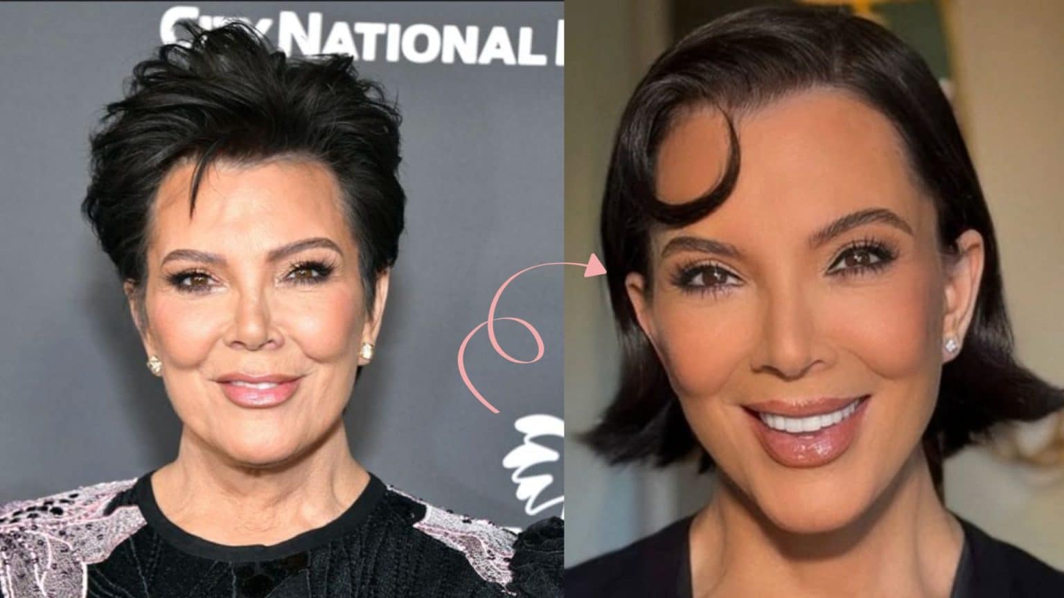 Kris Jenner Before and After: A Look at Her Changes - LA Story