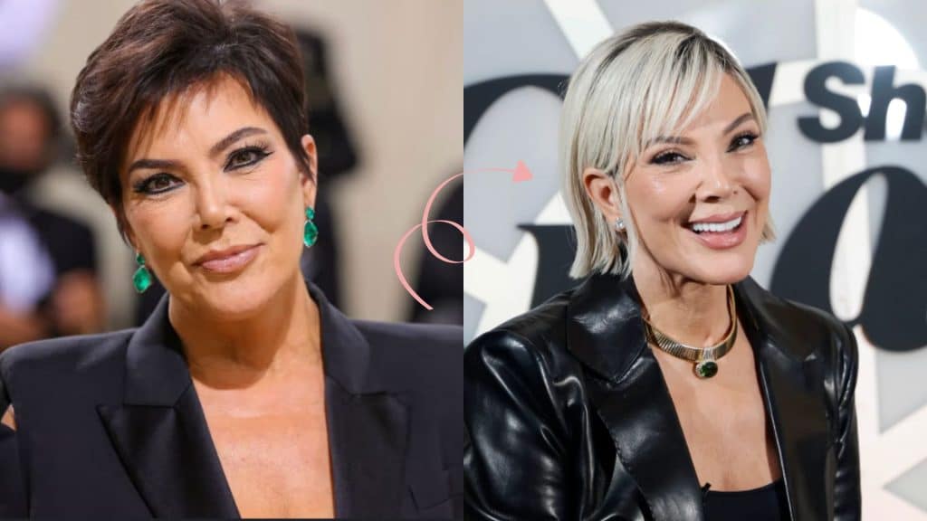 Kris Jenner Before and After: A Look at Her Changes - LA Story