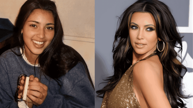 Kim Kardashian Before Surgery: The Real Look - LA Story